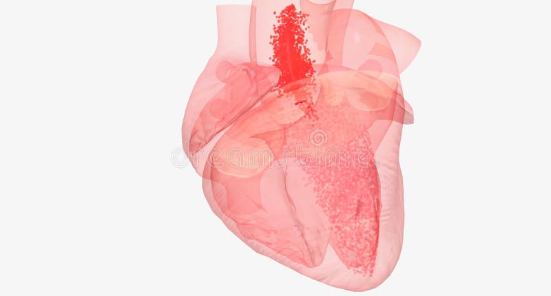 The Heart with Digitalis Preparations Stock Illustration - Illustration of muscle, aorta: 272792901