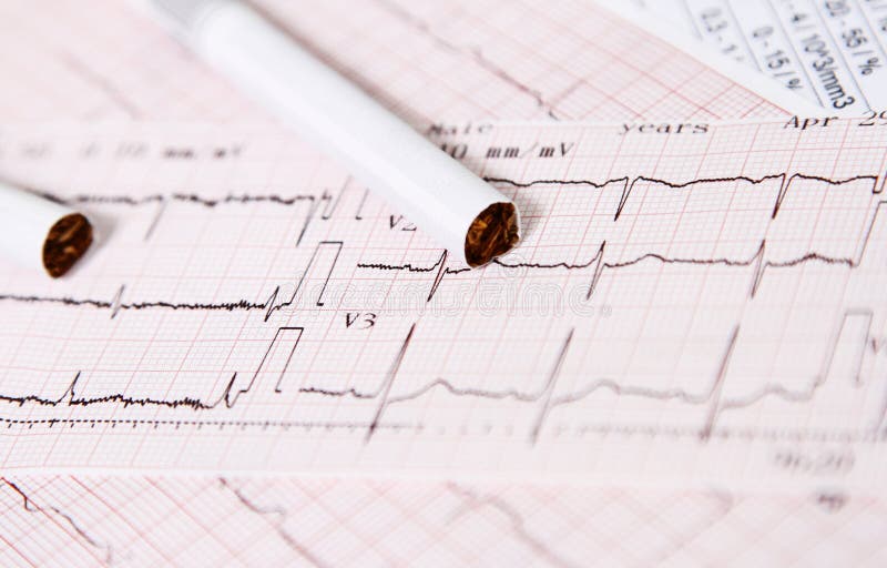 Heart Disease Caused by Cigarettes Stock Image - Image of exam ...