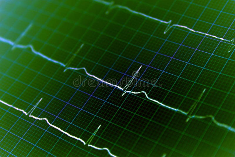 Heart ECG graph on paper stock photo. Image of graf, diagnosis - 2790554