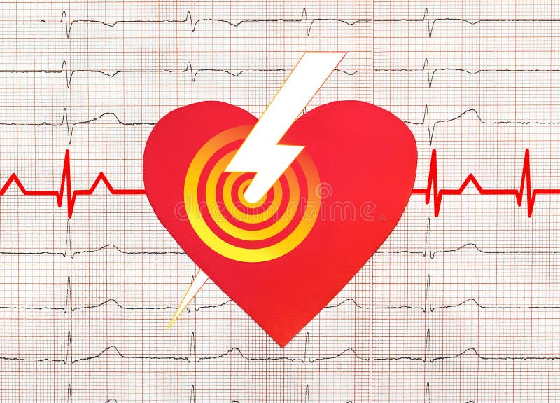 Heart With Electrocardiogram Test In The Background, Stock Image ...
