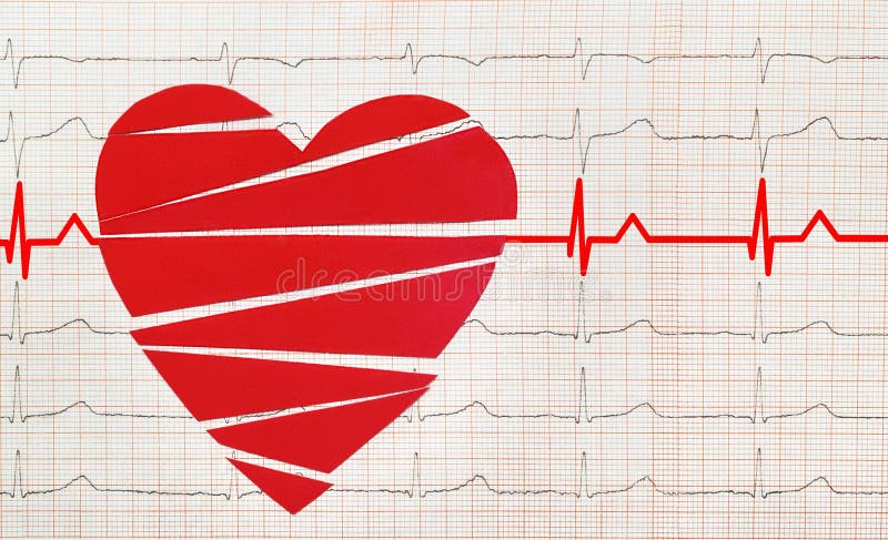 Heart with Electrocardiogram Test in the Background, Stock Image ...