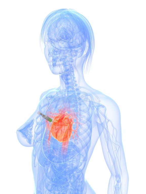 Heart injection stock illustration. Illustration of chemical - 14137192