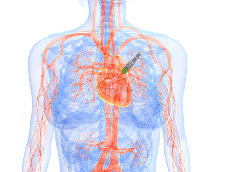 Heart injection stock illustration. Illustration of science - 14137204