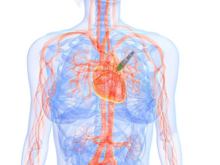 Heart injection stock illustration. Illustration of science - 14137204