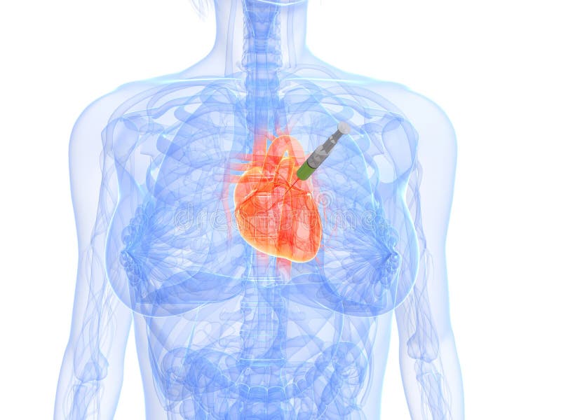 Heart Ekg Injection Symbol Isolated Stock Illustration - Illustration ...