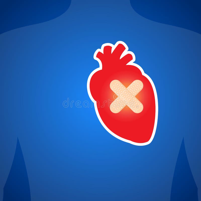 Heart injury. stock vector. Illustration of cardiology - 33612143