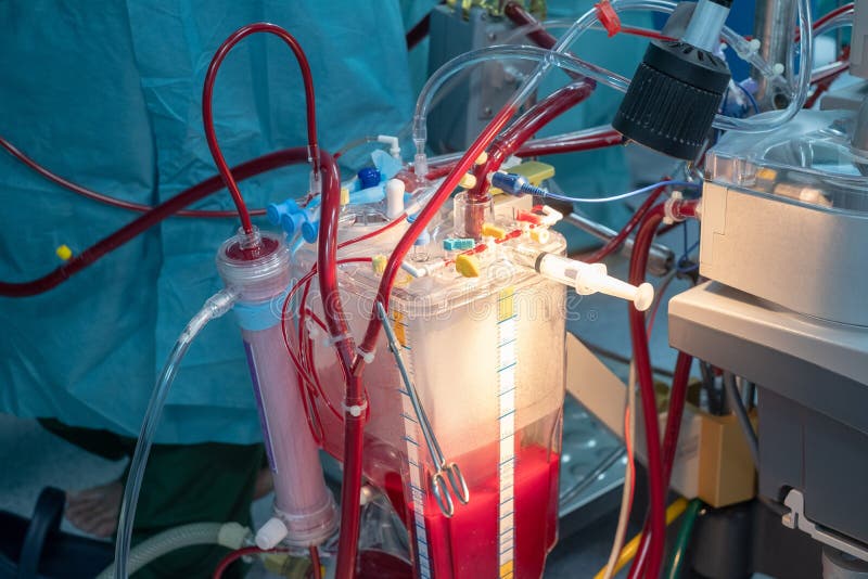 Heart Lung Machine for Heart Surgery in Operating Room. Stock Photo ...