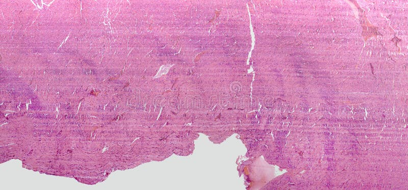 Heart micrography stock photo. Image of closeup, medicine - 81043156