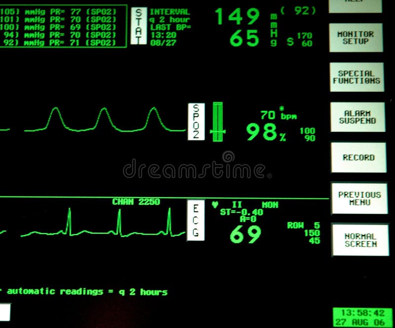 Heart Monitor stock image. Image of pressure, nurse, vital - 1160875