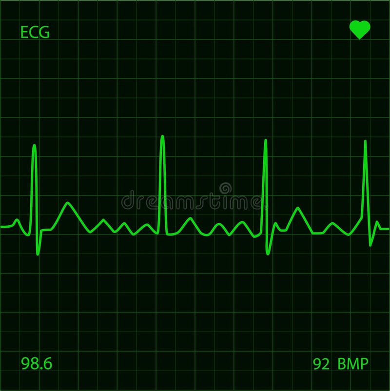 Heart monitor screen stock vector. Illustration of emergency - 4819539