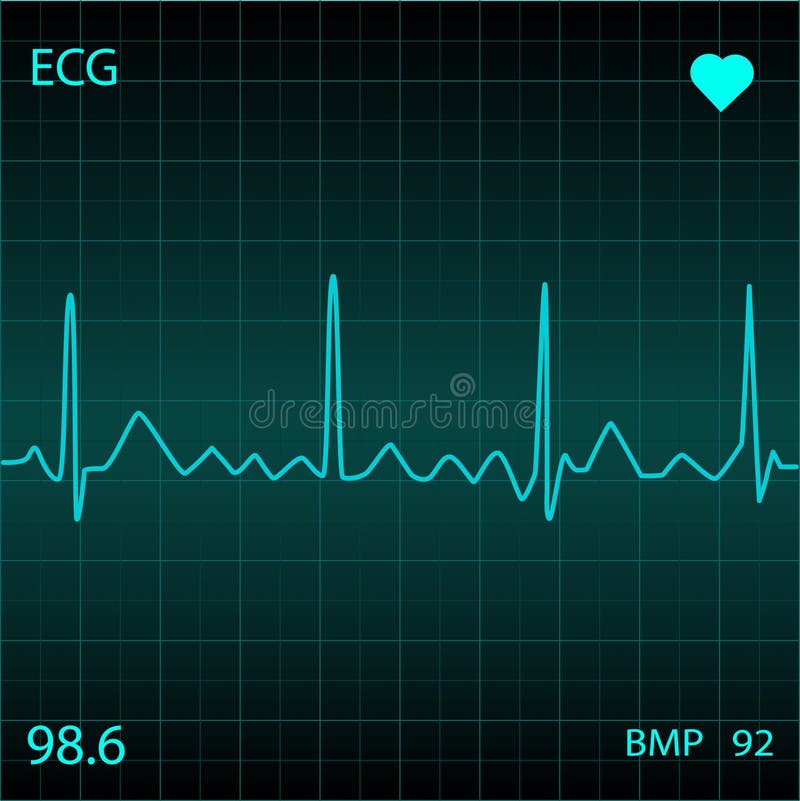 Heart Monitor stock vector. Illustration of line, heartbeat - 14611857