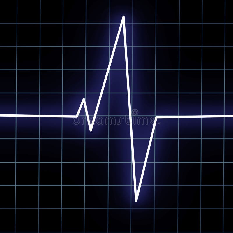 Heart Monitor Black Stock Illustrations – 7,409 Heart Monitor Black ...