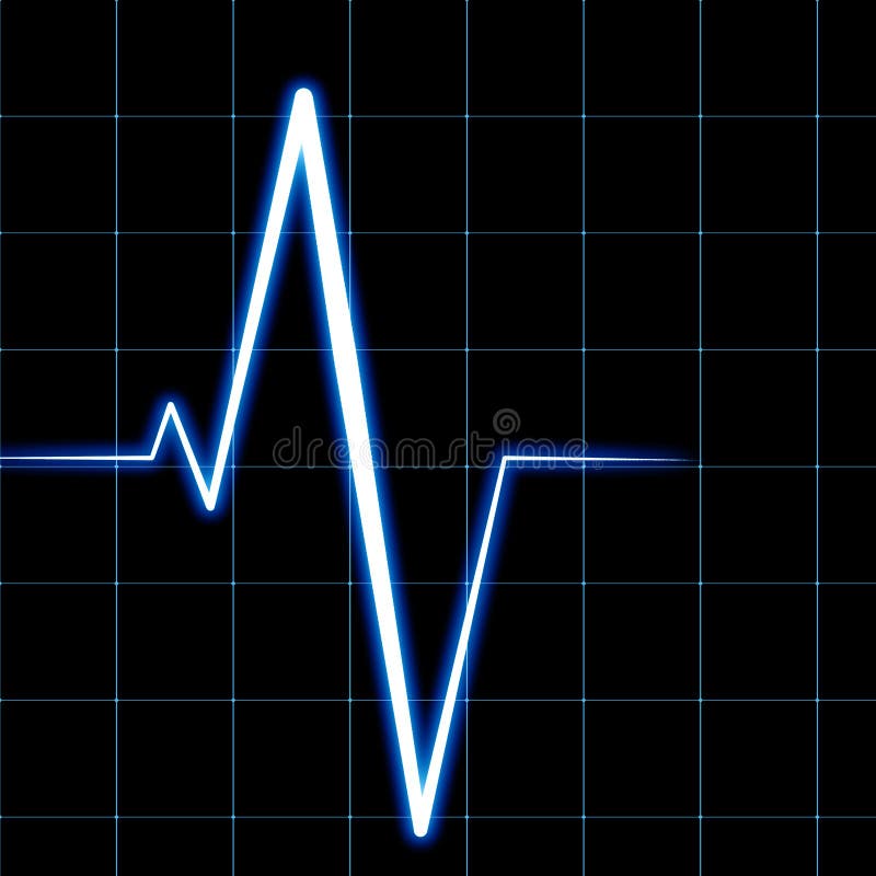Heart monitor stock illustration. Illustration of monitoring - 4216047