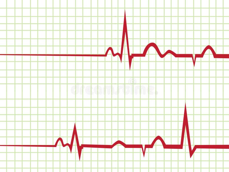 Heart monitor stock vector. Illustration of heart, cardiology - 5334108