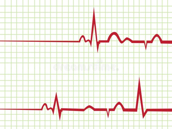 Heart monitor stock vector. Illustration of heart, cardiology - 5334108