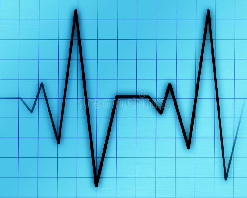 Heart beat stock illustration. Illustration of hospital - 2802164