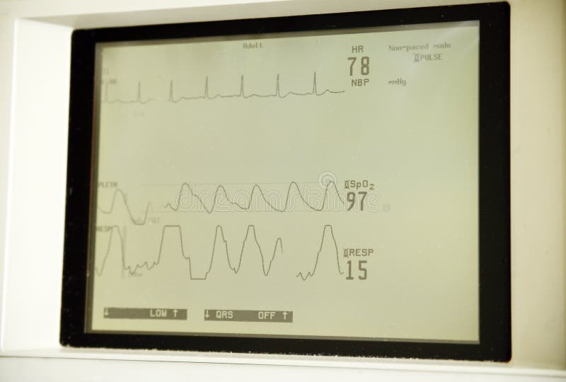 Heart monitor stock image. Image of bedside, computer - 17994359