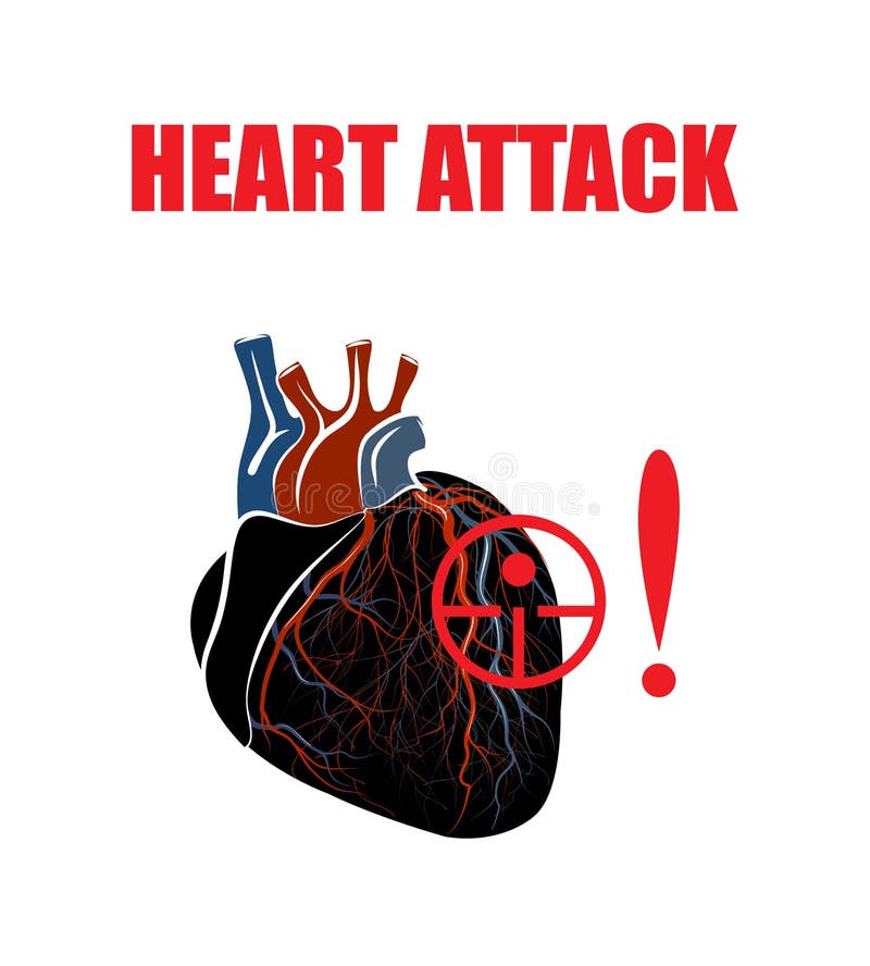 Myocardial Tissue Stock Illustrations – 40 Myocardial Tissue Stock ...