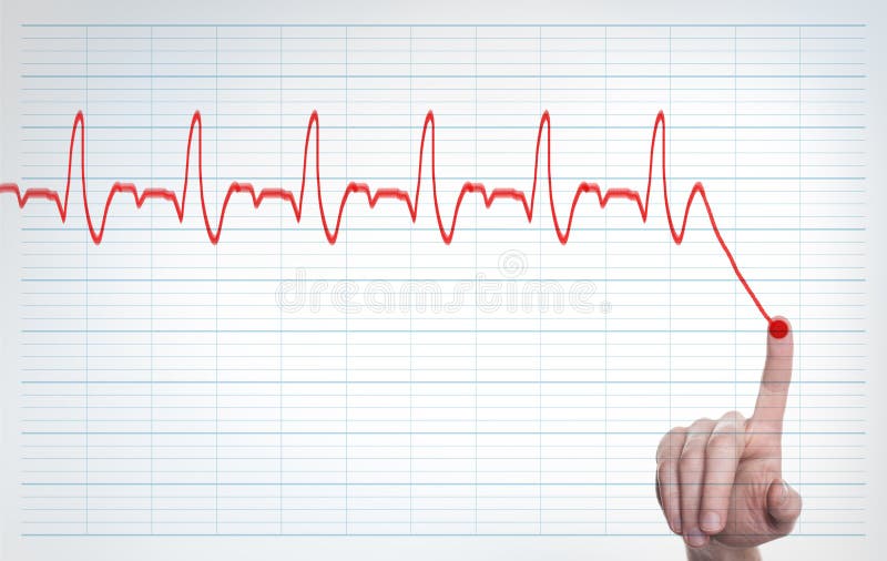 Heart Pulse, One Line with Hand, Cardiogram. Concept Stock Image ...
