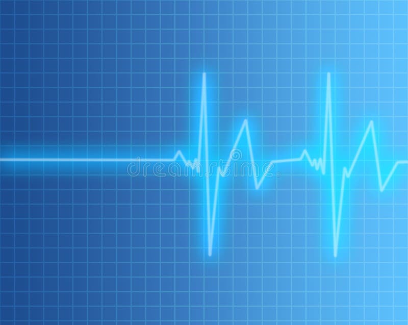 Ecg Ekg Heart Rate Monitor Screen With Audio Stock Trace Monitor