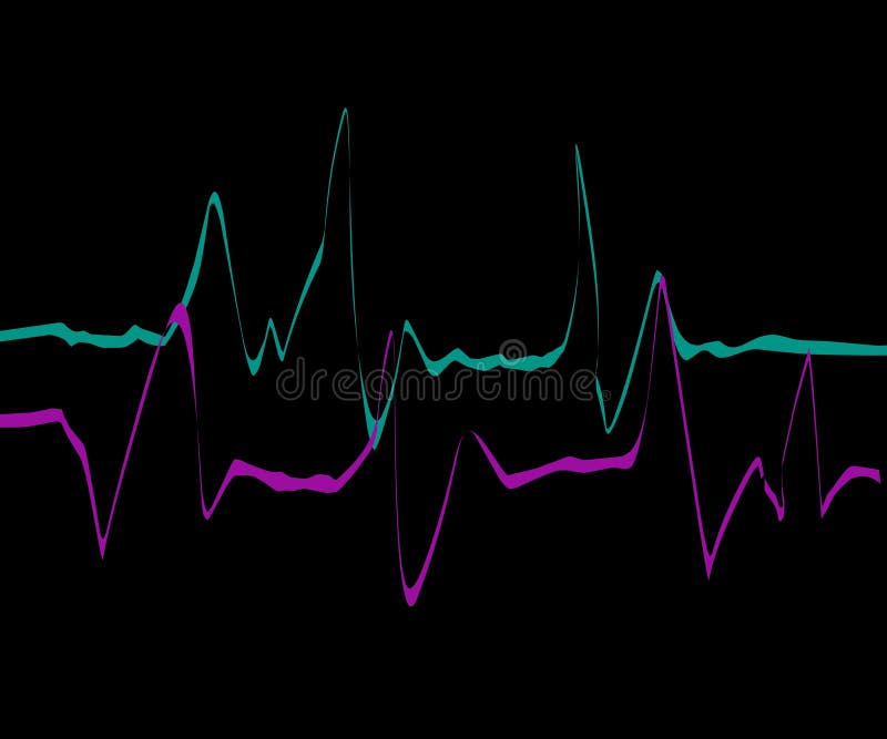 Heart Rate Pattern Diagram Illustration Stock Illustration ...