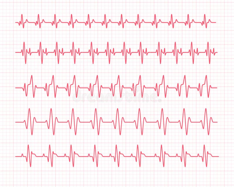 Heart Rhythm Graph Checking Your Heartbeat for Diagnosis Stock Vector ...