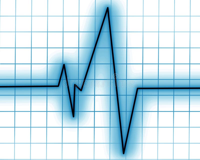 Heartbeat stock illustration. Illustration of medical - 2950832