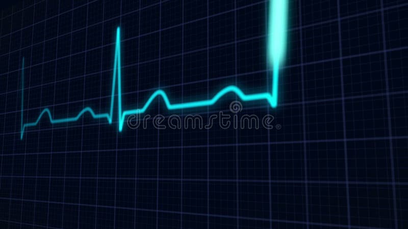Blue Heartbeat Monitor EKG Line Monitor with Moving Camera Processing ...