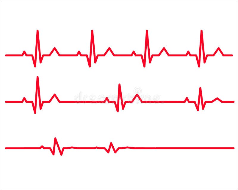 Heartbeat Line Pulse Line Isolated on White Background. Vector ...