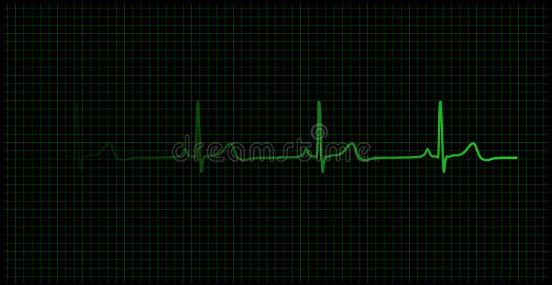 Heartbeat Normal ECG graph stock illustration. Illustration of muscular ...