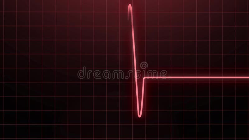 Heartbeat Stock Footage & Videos - 10,335 Stock Videos