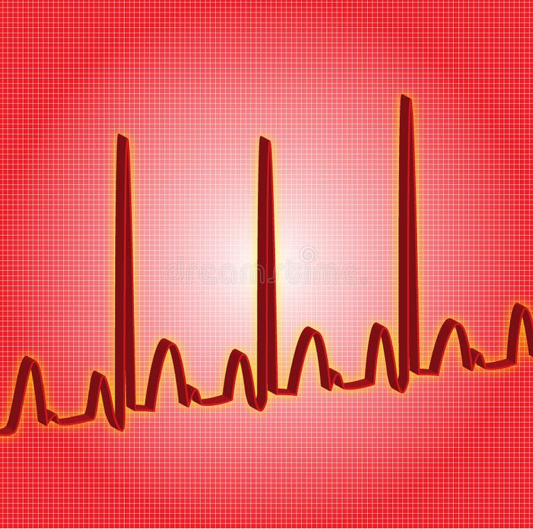 Heart Beat Red Stock Illustrations – 13,008 Heart Beat Red Stock ...