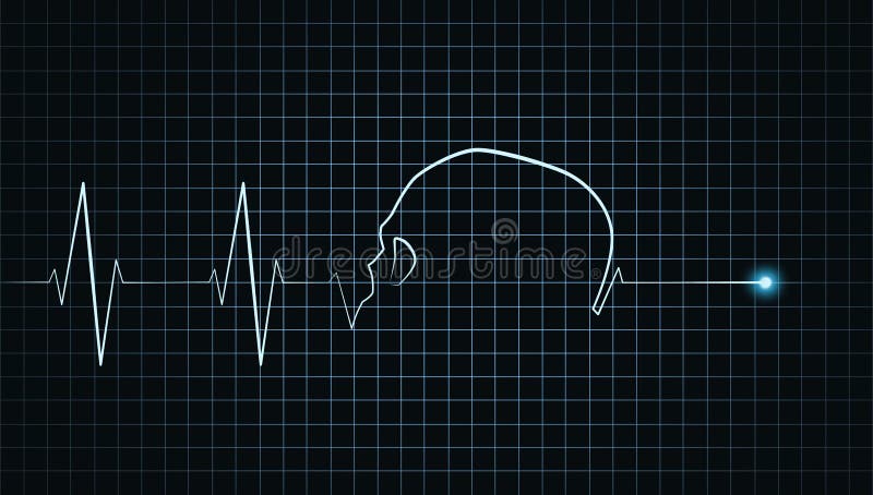 Heartbeat stop cardiogram stock illustration. Illustration of heartbeat ...