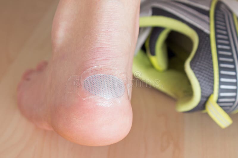Heel stock photo. Image of sports, excoriated, feet, shoes - 37089344