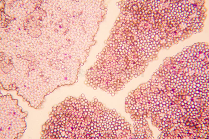 Knospungshefezellen Mit Pseudohyphae Stockfoto - Bild von bakterium ...