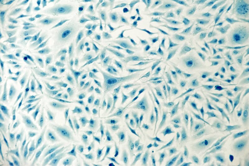 HeLa Cervical Cancer Cells Stock Photo - Image: 61748278