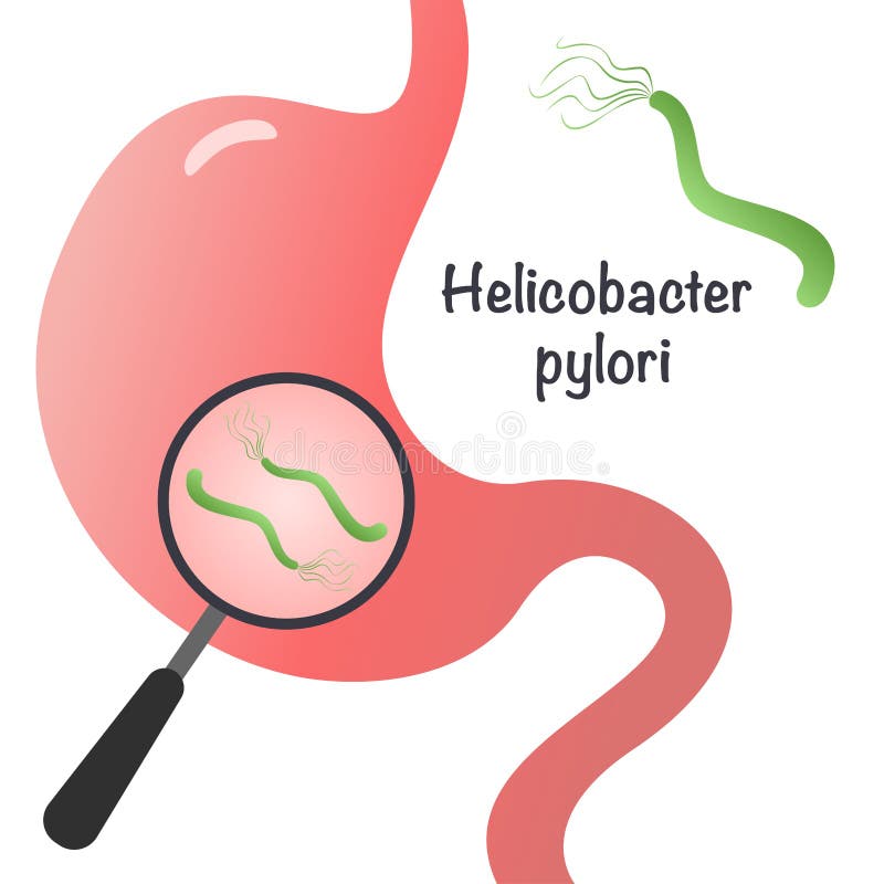 Helicobacter Pylori Vector Illustration Stock Vector - Illustration of ...