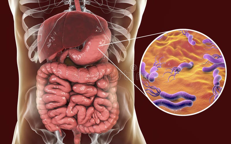 Helicobacter Pylori, Bacterium Colonizing Stomach Stock Illustration ... Helicobacter Pylori, Bacterium Colonizing Stomach Stock Illustration ...