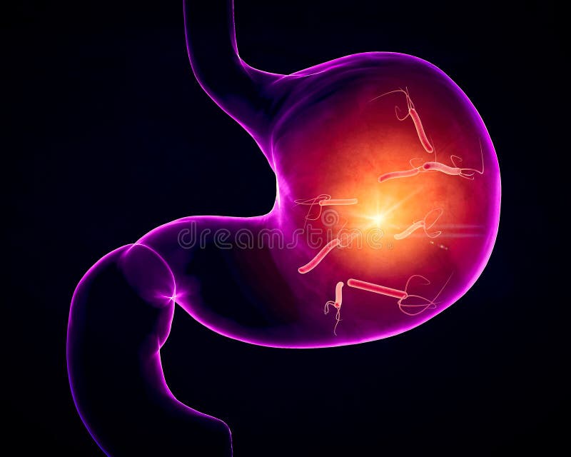 Helicobacter Pylori is a Gram-negative, Flagellated, Helical Bacterium ...