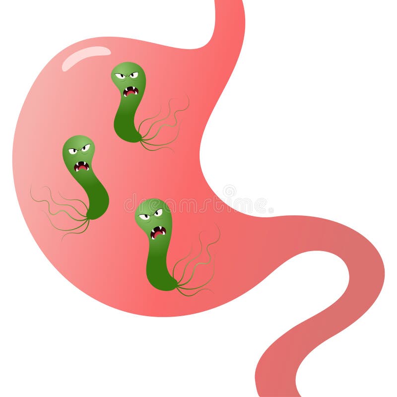 Helicobacter Pylori Vector Illustration Stock Vector - Illustration of ...