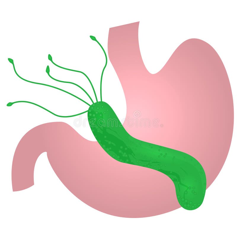 Helicobacter Pylori in the Stomach Stock Vector - Illustration of ...