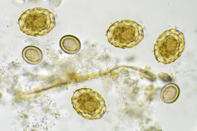 Helminthes in stool stock photo. Image of hookworm, laboratory - 101577230