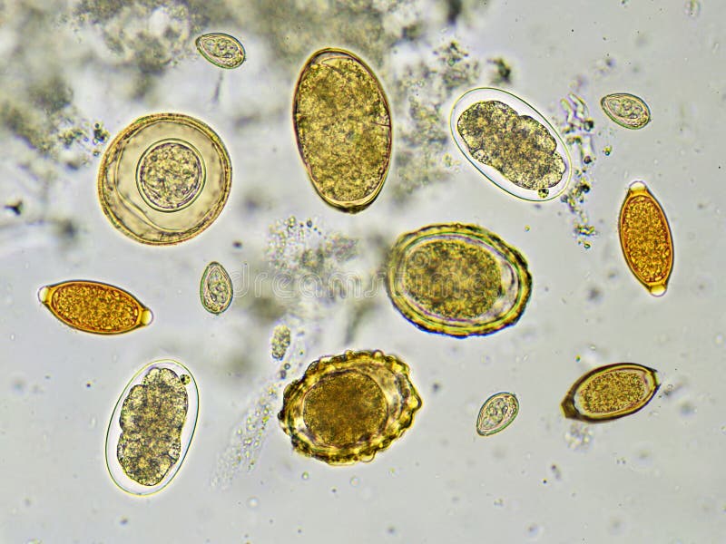 Helminthes in stool stock photo. Image of hookworm, laboratory - 101577230