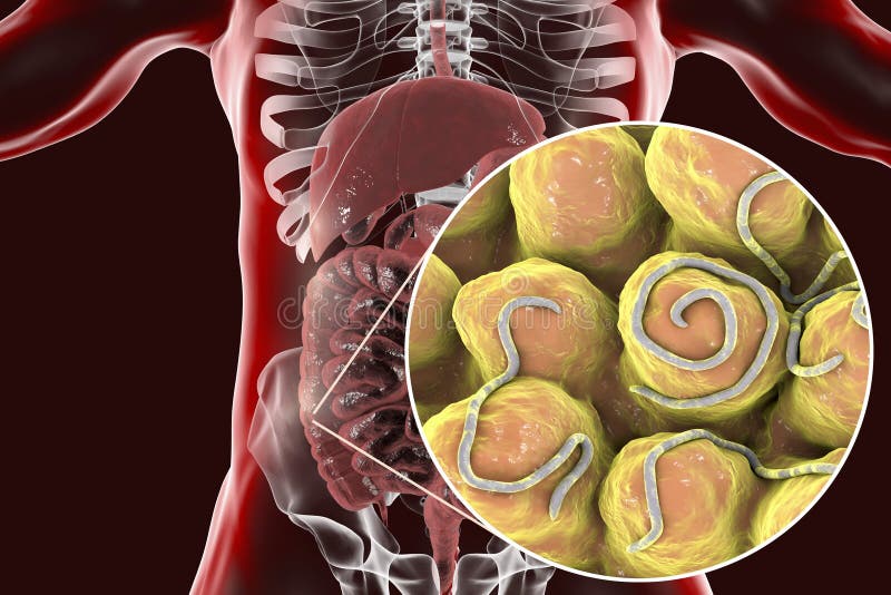 Helminths Nematodes Enterobius in the Gut Stock Illustration ...