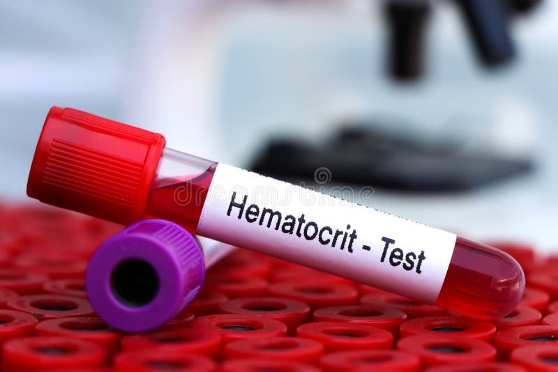 Hematocrit Test To Look for Abnormalities from Blood Stock Image ...