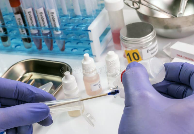 Hematological Analysis with Forensic Test Kit in a Murder in a Crime ...