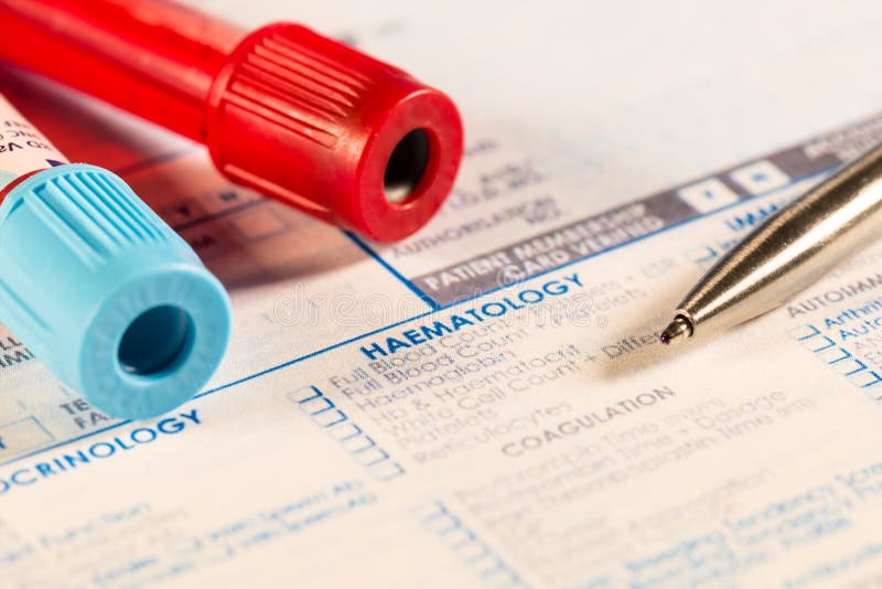 Hematological blood tests stock image. Image of oncology - 31069285