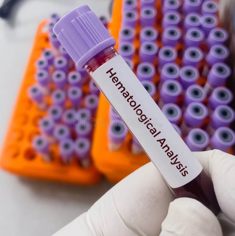 Hematologist Holding Lavender Tube with Blood for Hematological ...