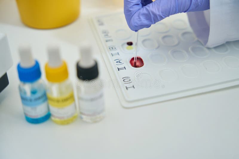 Hematologist Works with Blood Samples on an Indication Palette Stock ...
