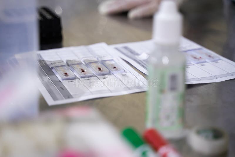 Hematology Analysis Report Medical Diagnosis Stock Photo - Image of ...